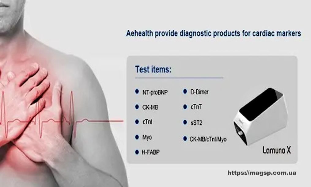 Імунофлуоресцентний аналізатор Aehealth Lamuno X – купити в Україні ...